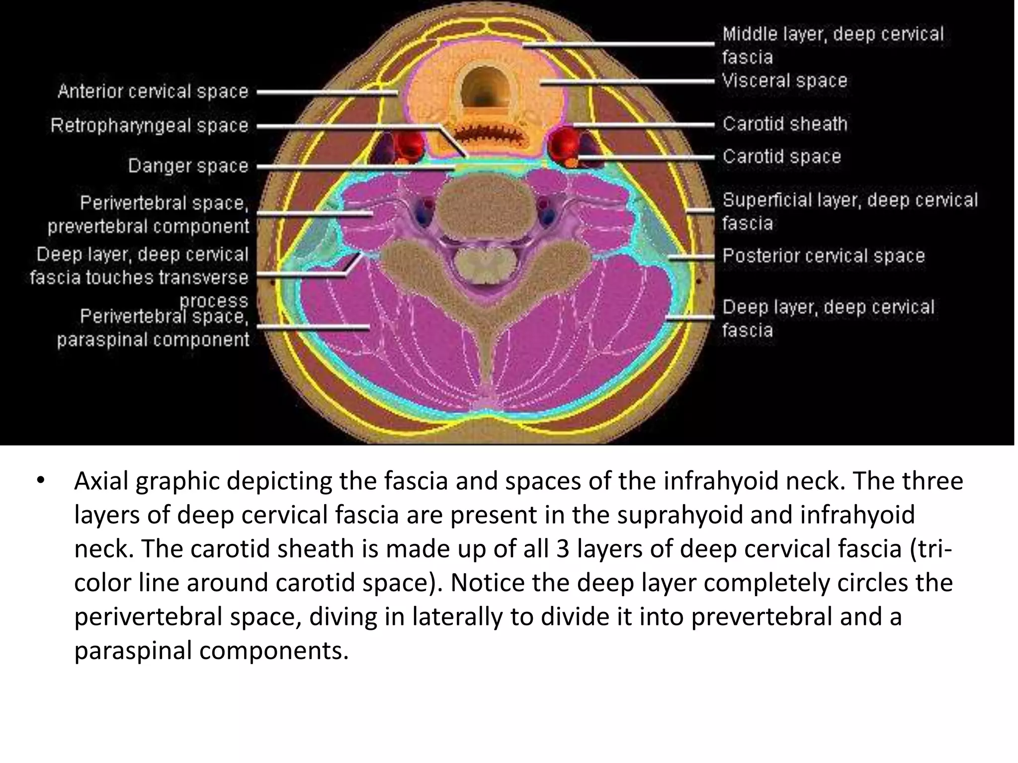 Radiological approach to neck spaces | PPTX