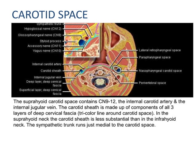 Radiological approach to neck spaces | PPTX