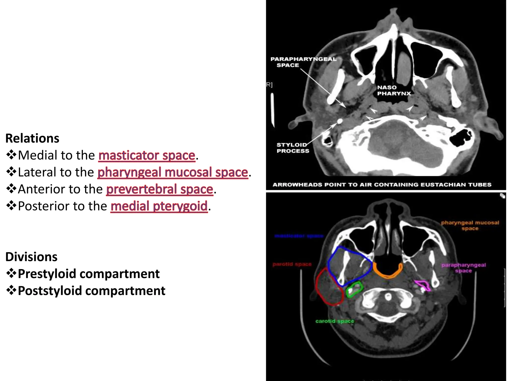 Anatomy of Deep Neck spaces Radiology Pictorial representation | PPTX