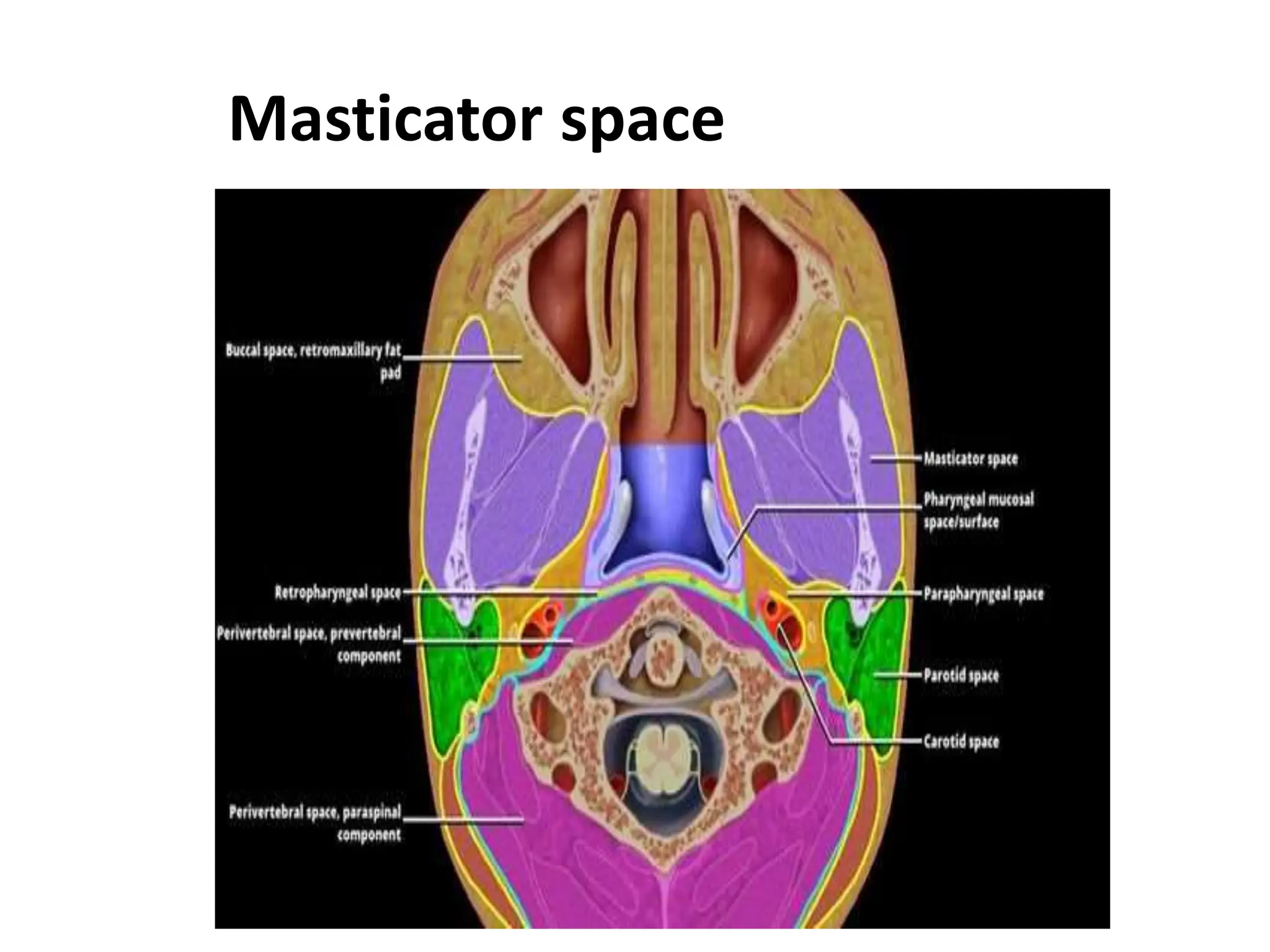 Anatomy of Deep Neck spaces Radiology Pictorial representation | PPTX