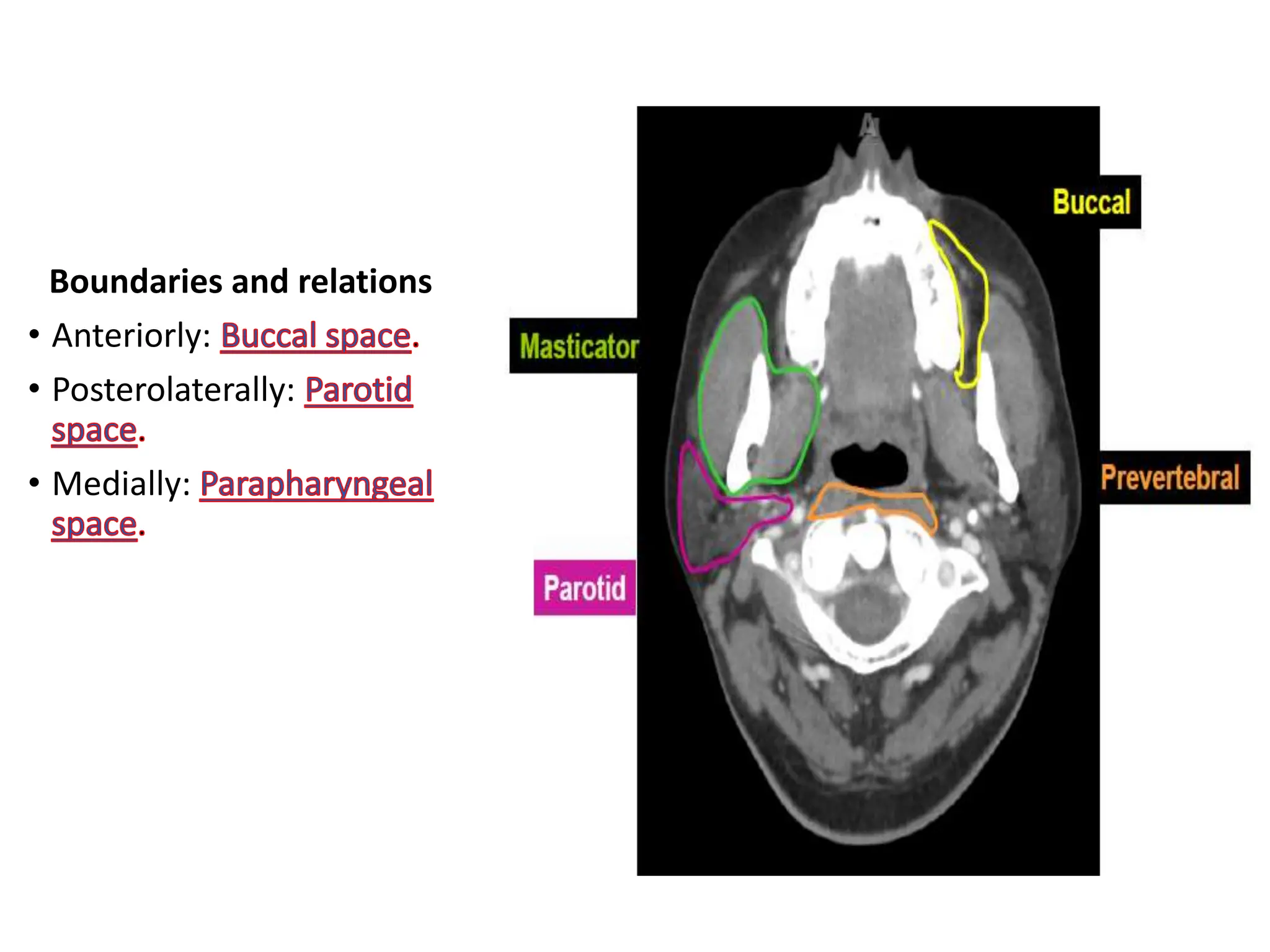 Anatomy of Deep Neck spaces Radiology Pictorial representation | PPTX