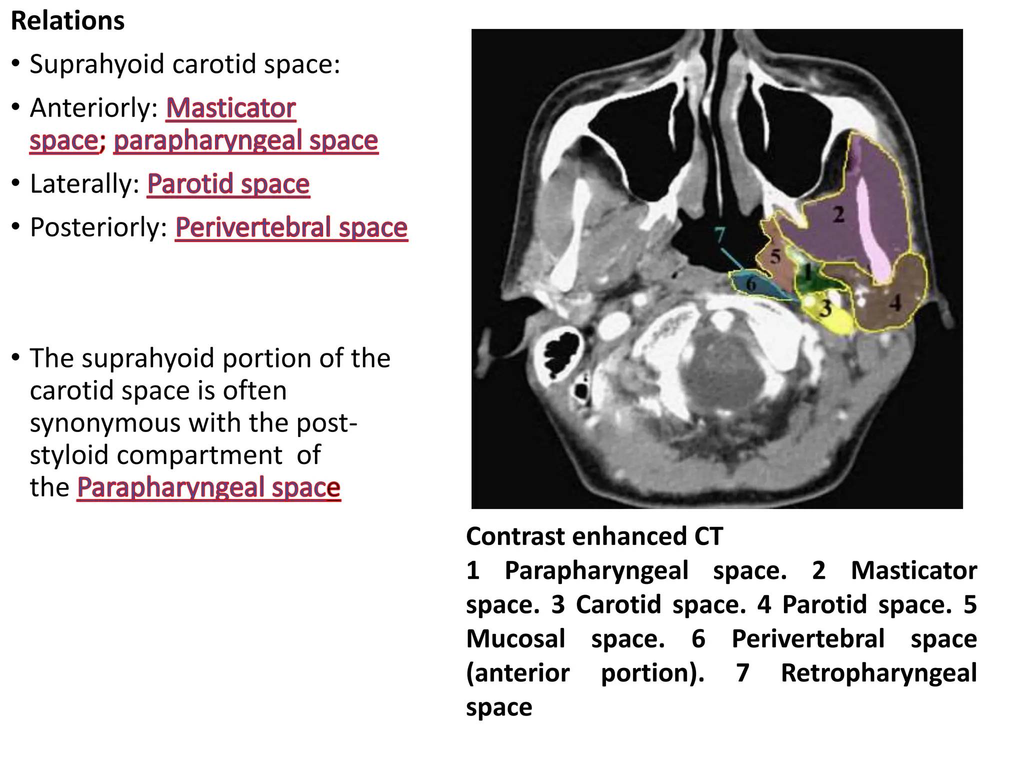 Anatomy of Deep Neck spaces Radiology Pictorial representation | PPTX
