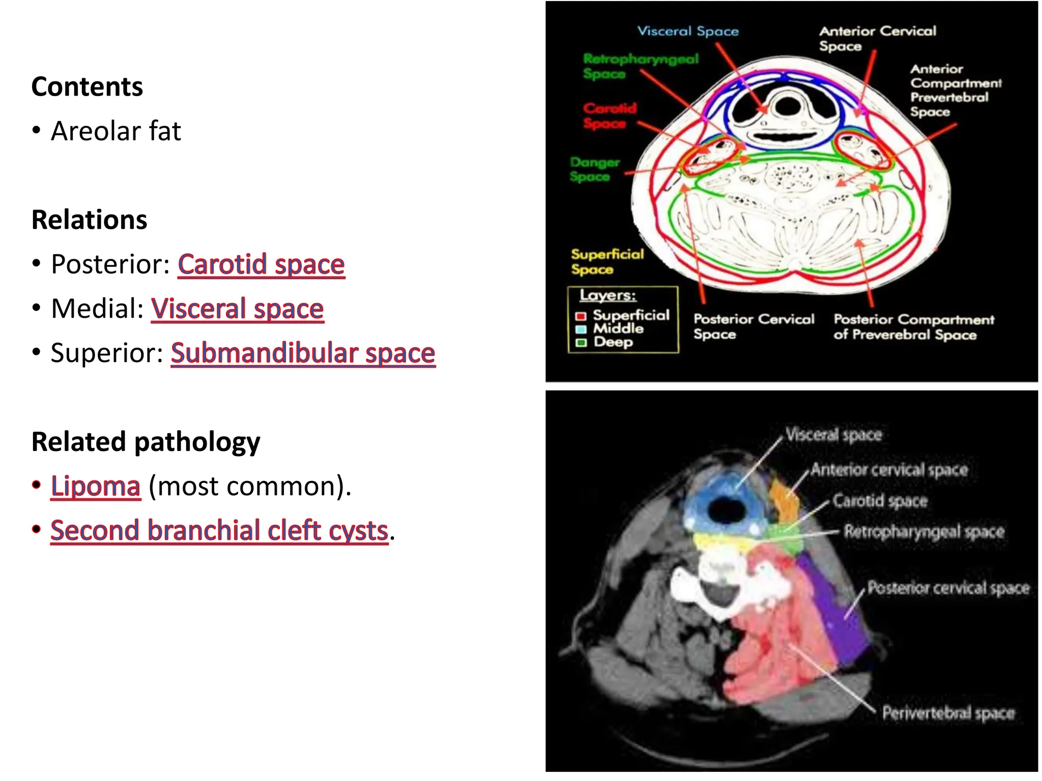 Anatomy of Deep Neck spaces Radiology Pictorial representation | PPTX