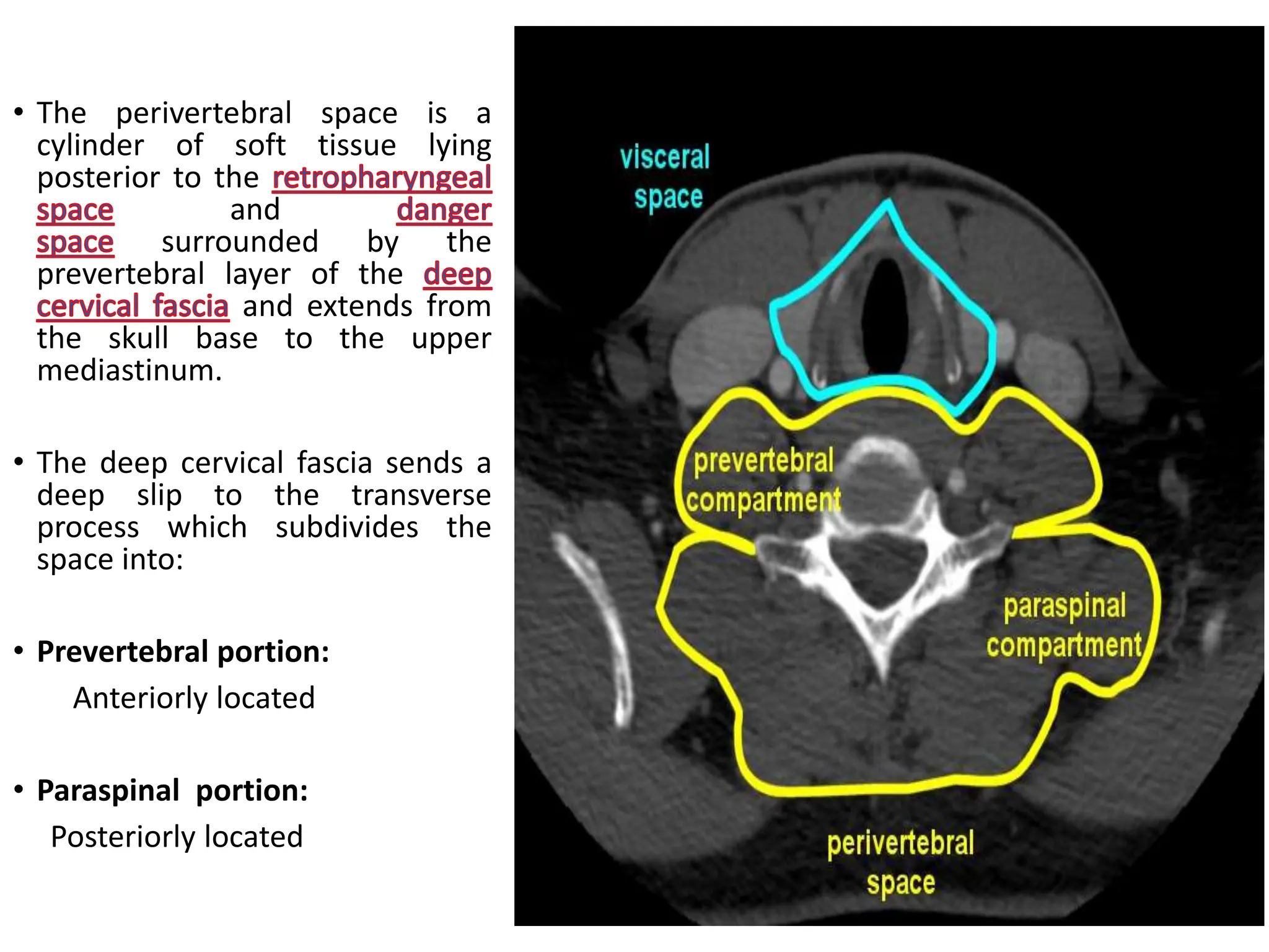 Anatomy of Deep Neck spaces Radiology Pictorial representation | PPTX