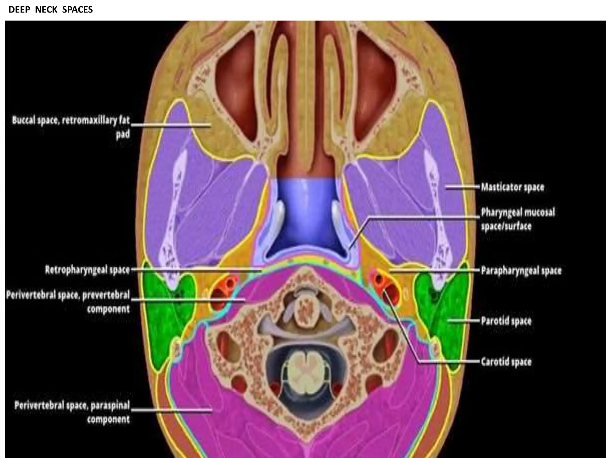 Anatomy of Deep Neck spaces Radiology Pictorial representation | PPTX