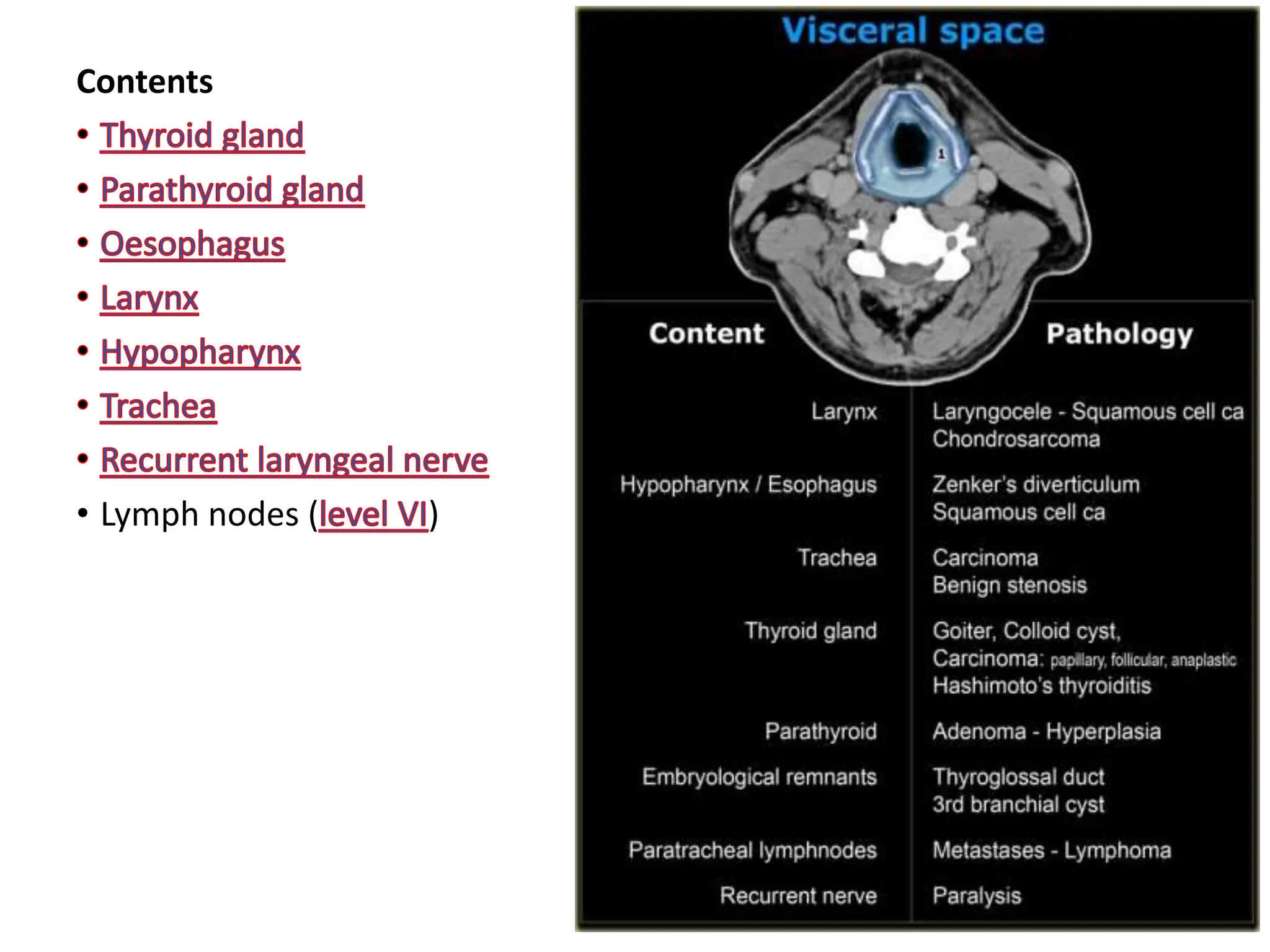 Anatomy of Deep Neck spaces Radiology Pictorial representation | PPTX