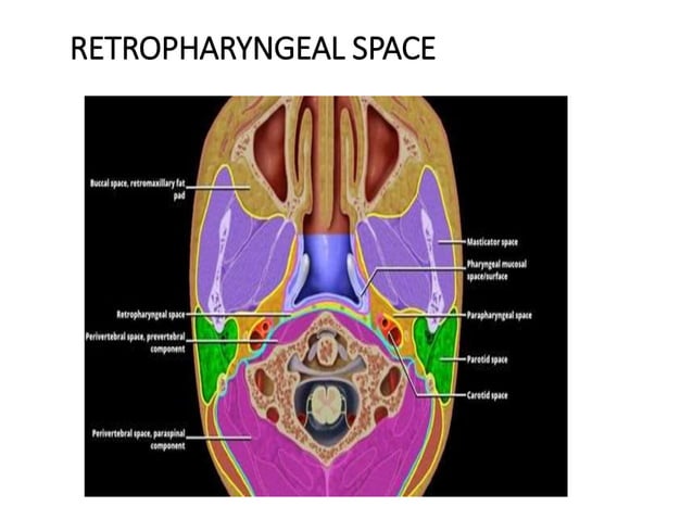 Anatomy of Deep Neck spaces Radiology Pictorial representation | PPTX