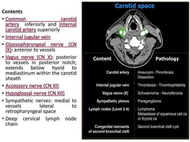 Anatomy of Deep Neck spaces Radiology Pictorial representation | PPTX