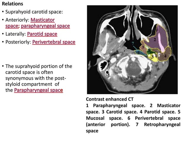 Anatomy of Deep Neck spaces Radiology Pictorial representation | PPTX