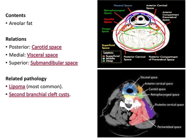 Anatomy of Deep Neck spaces Radiology Pictorial representation | PPT