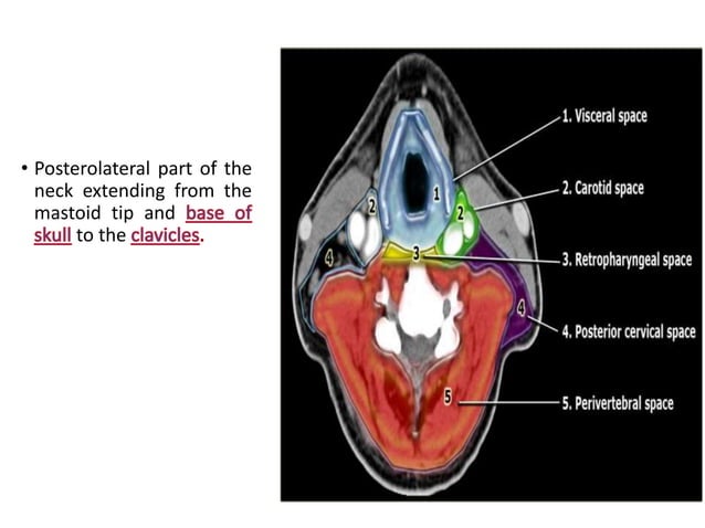 Anatomy of Deep Neck spaces Radiology Pictorial representation | PPTX