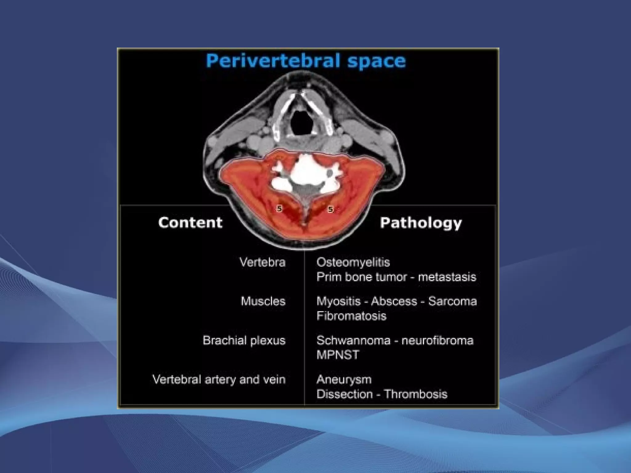 Anatomy of neck spaces and levels of cervical | PPT