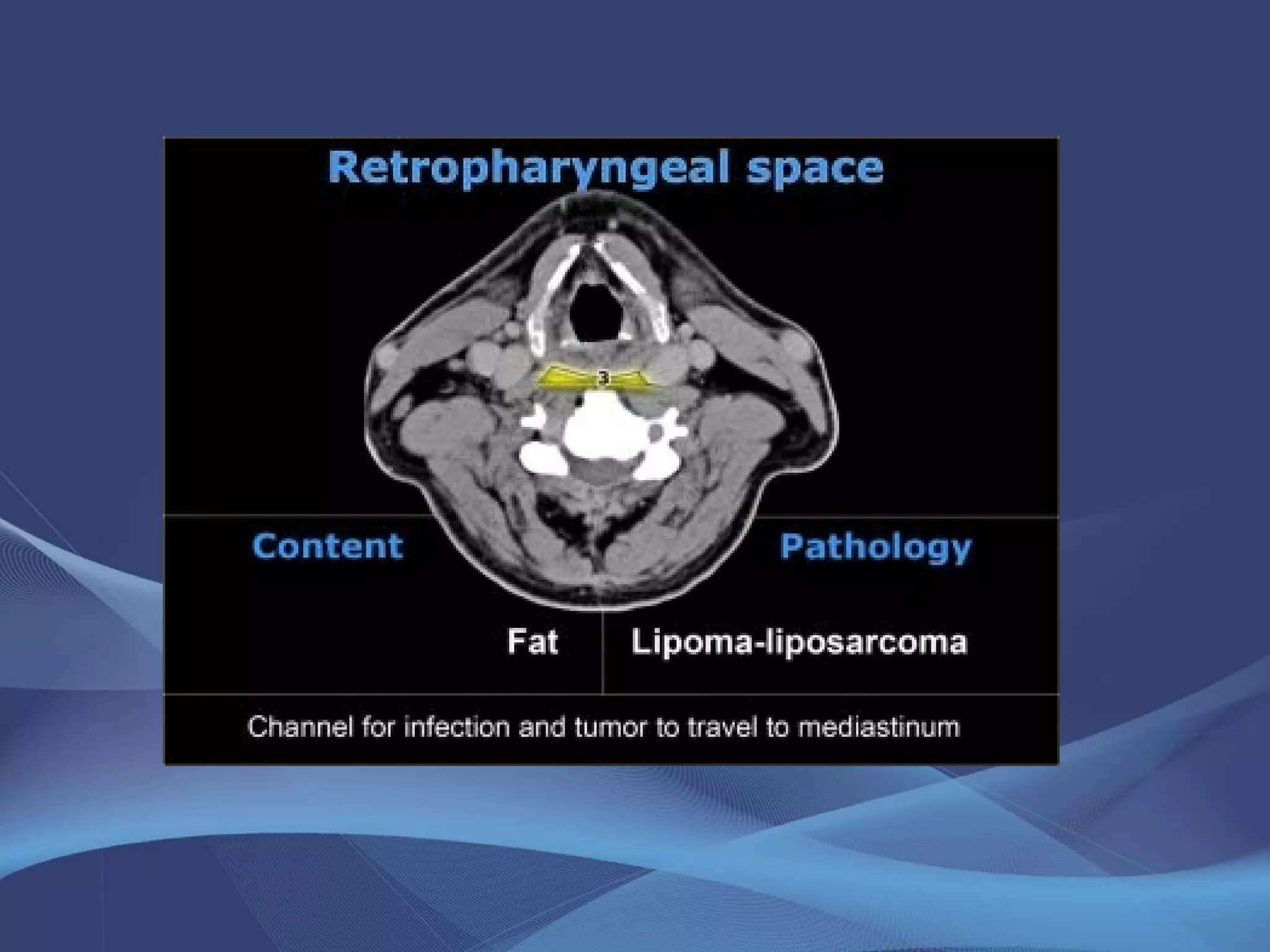 Anatomy of neck spaces and levels of cervical | PPT
