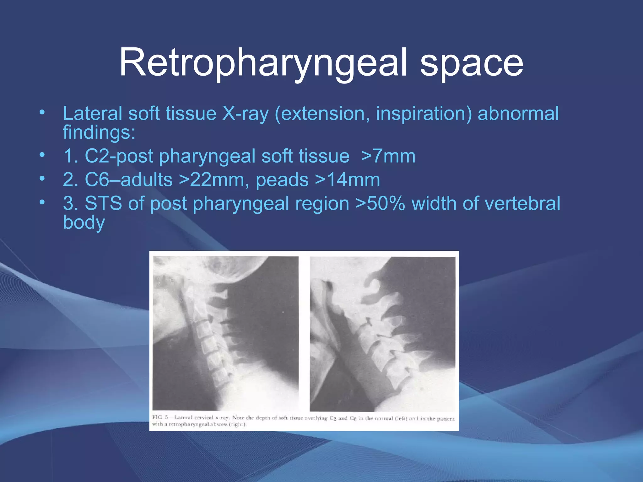 Anatomy of neck spaces and levels of cervical | PPT