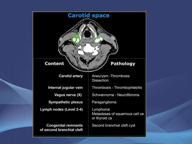 Anatomy of neck spaces and levels of cervical | PPT | Thyroid Disorders ...
