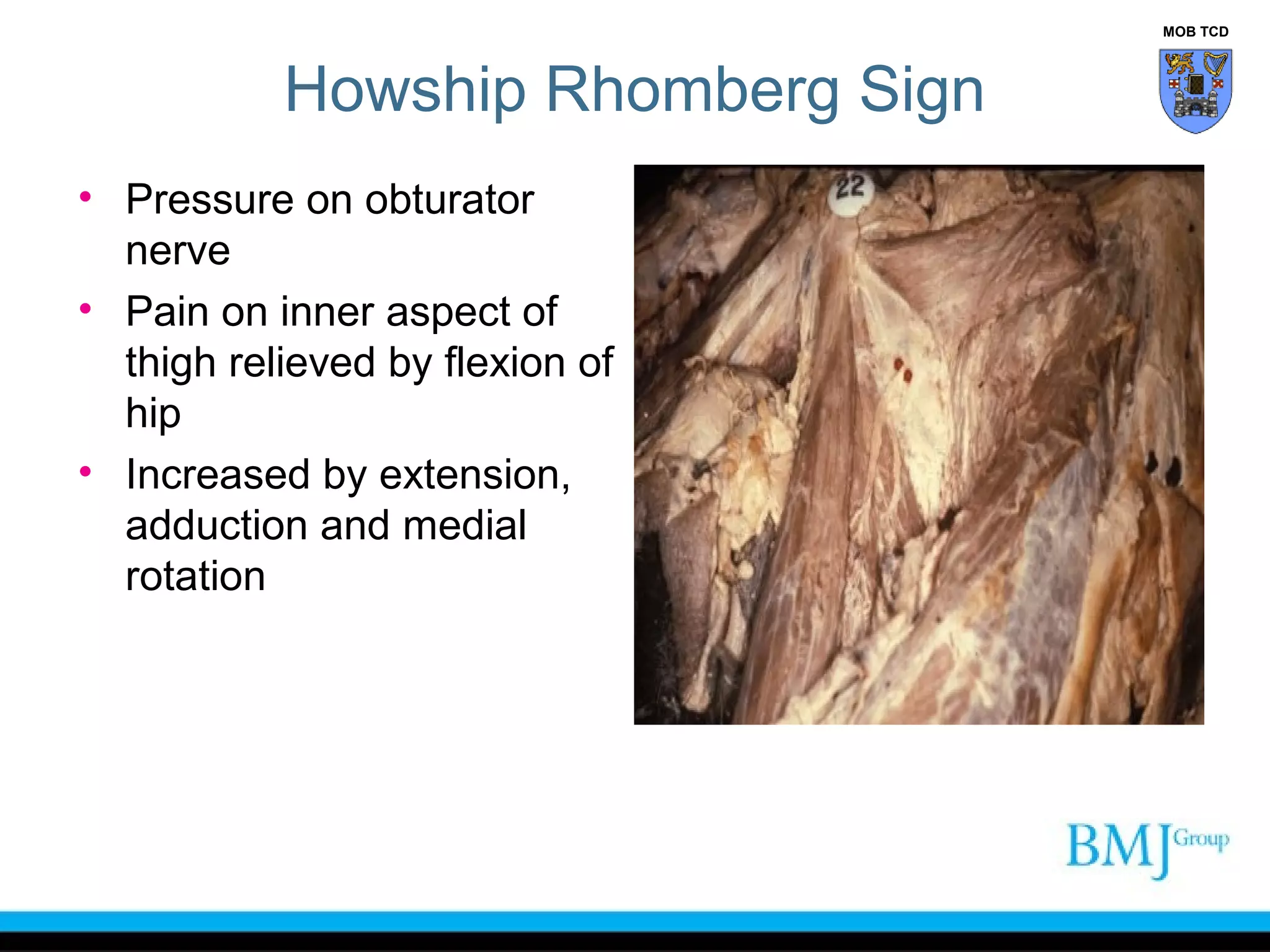 Anatomy of nerve_injuries_lower_limb | PPT