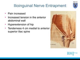 Ilioinguinal Nerve Entrapment