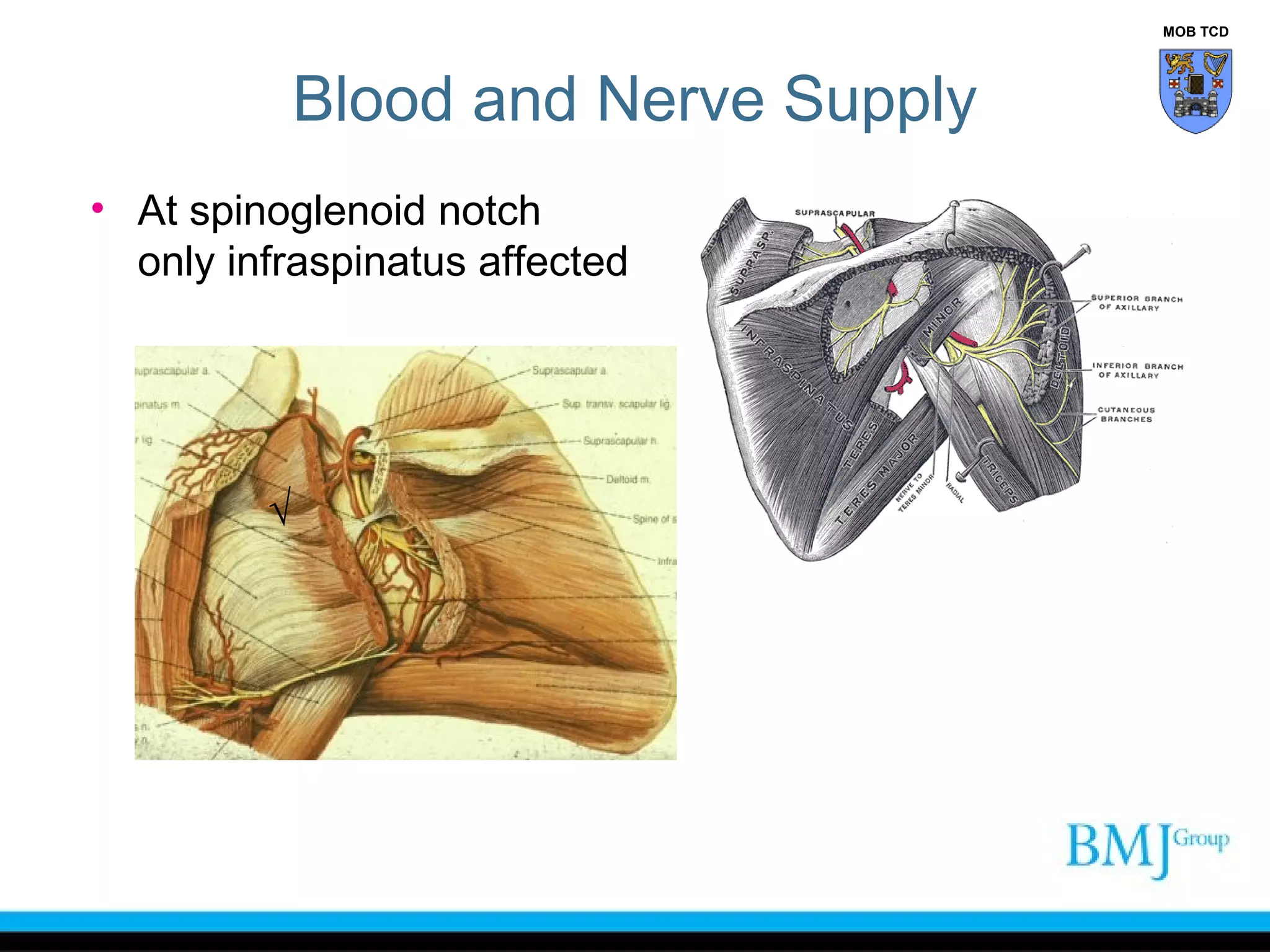 Anatomy of nerve injuries upper limb | PPT