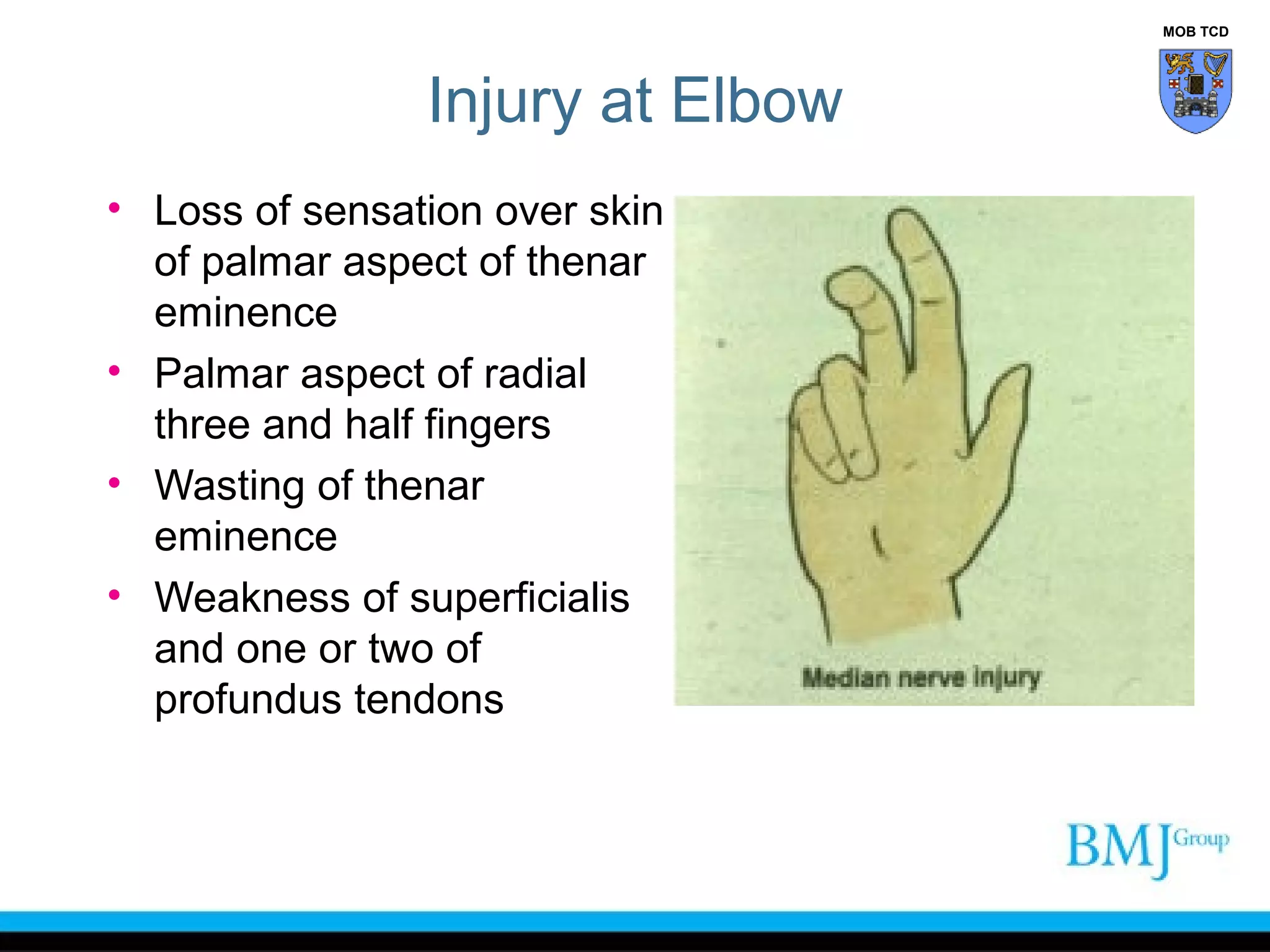 Anatomy of nerve injuries upper limb | PPT