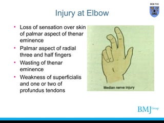 Anatomy of nerve injuries upper limb | PPT