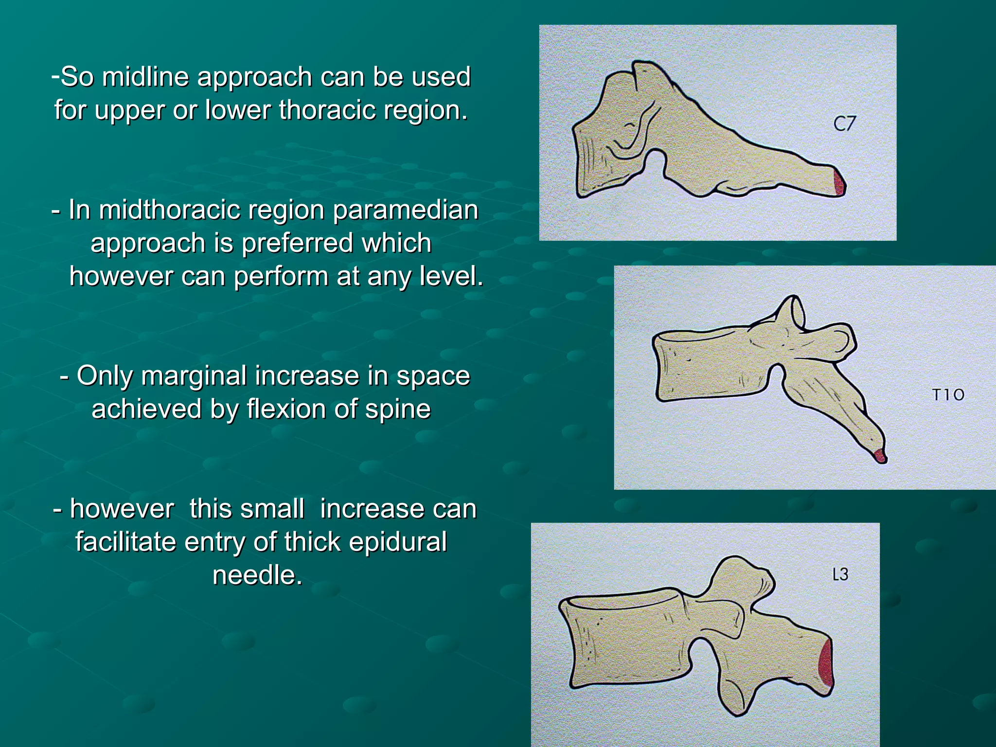 Anatomy of neuroaxial system final | PPT