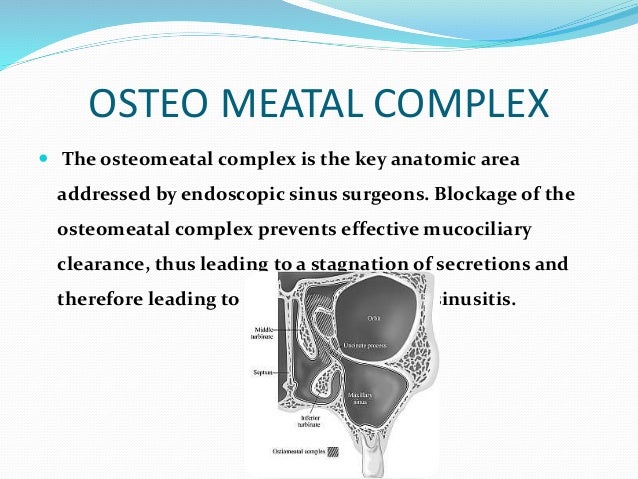 Ostiomeatal Complex Obstruction