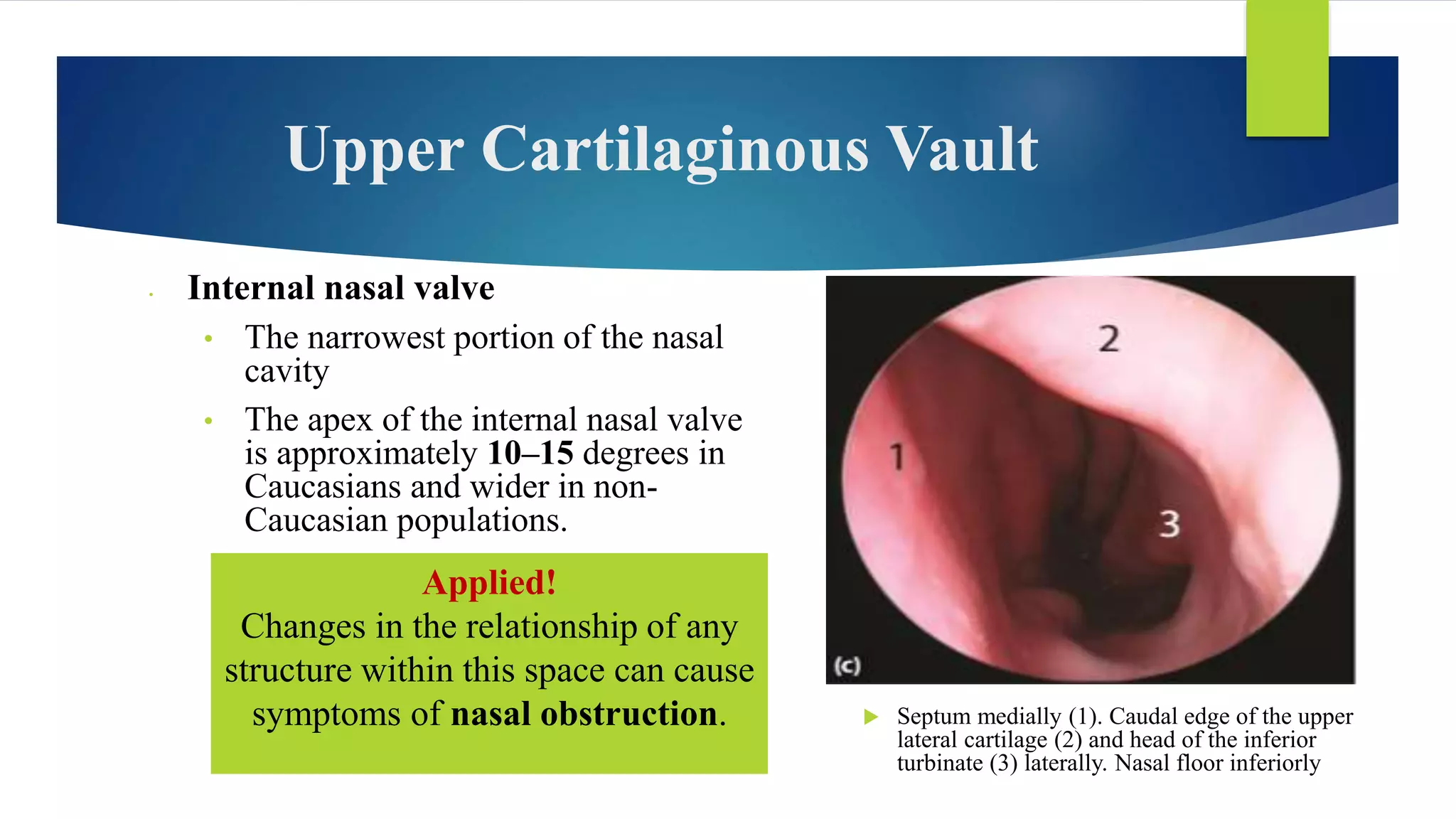 Anatomy of nose (Applied) | PPTX
