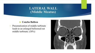 Anatomy of nose (Applied) | PPTX