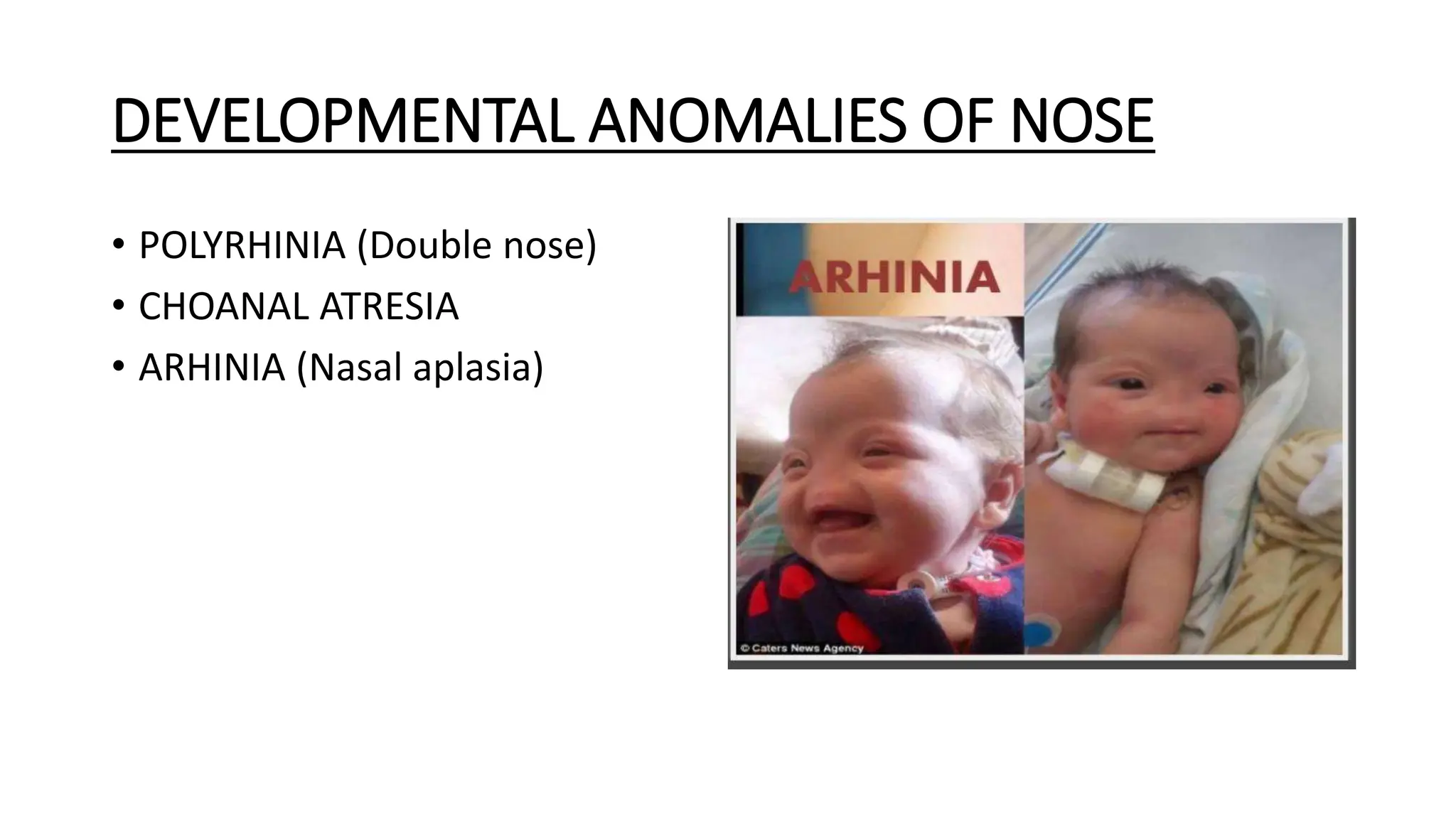 Anatomy of nose.pptx