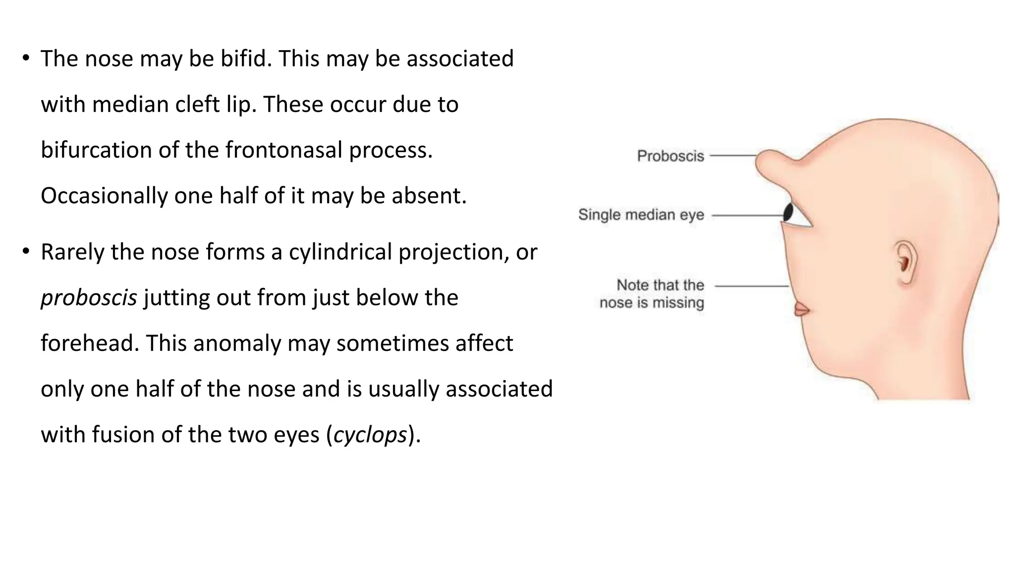 PRESENTATION ON ANATOMY OF NOSE FOR UNDERGRADUATES | PPTX