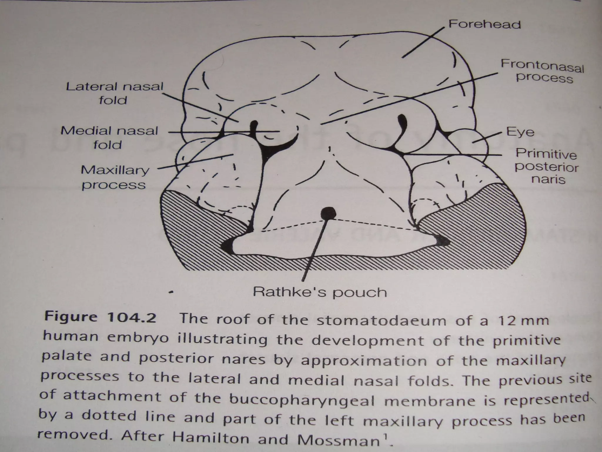 Anatomy of nose and paranasal sinuses | PPT