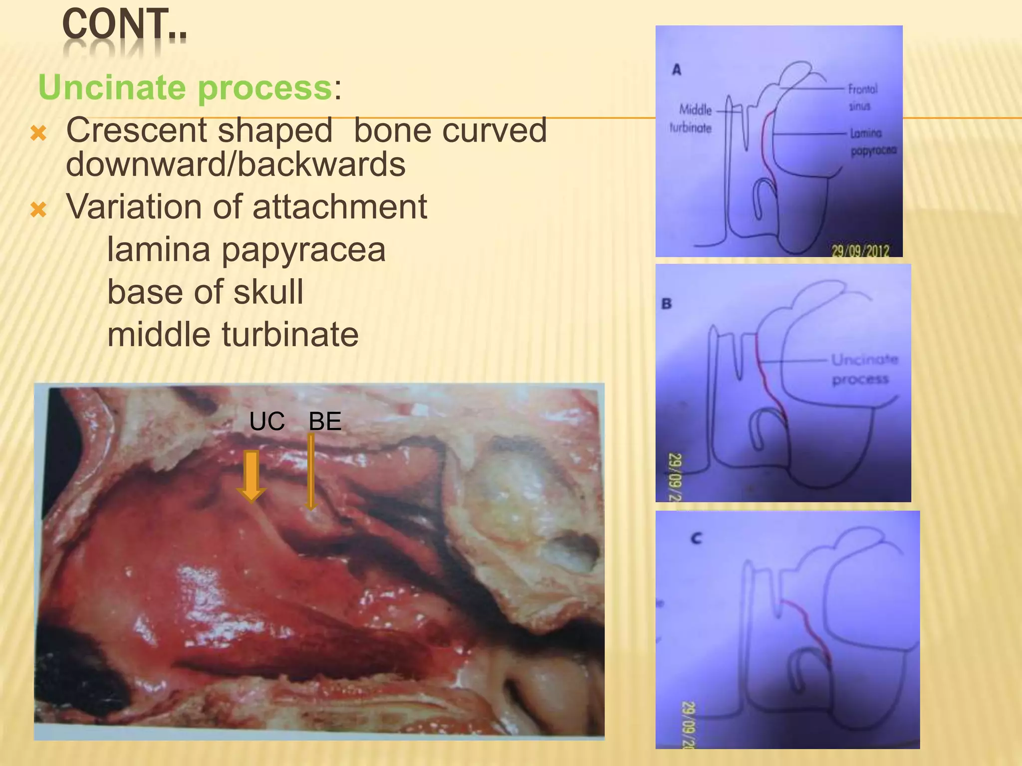 Anatomy of nose and paranasal sinuses | PPTX