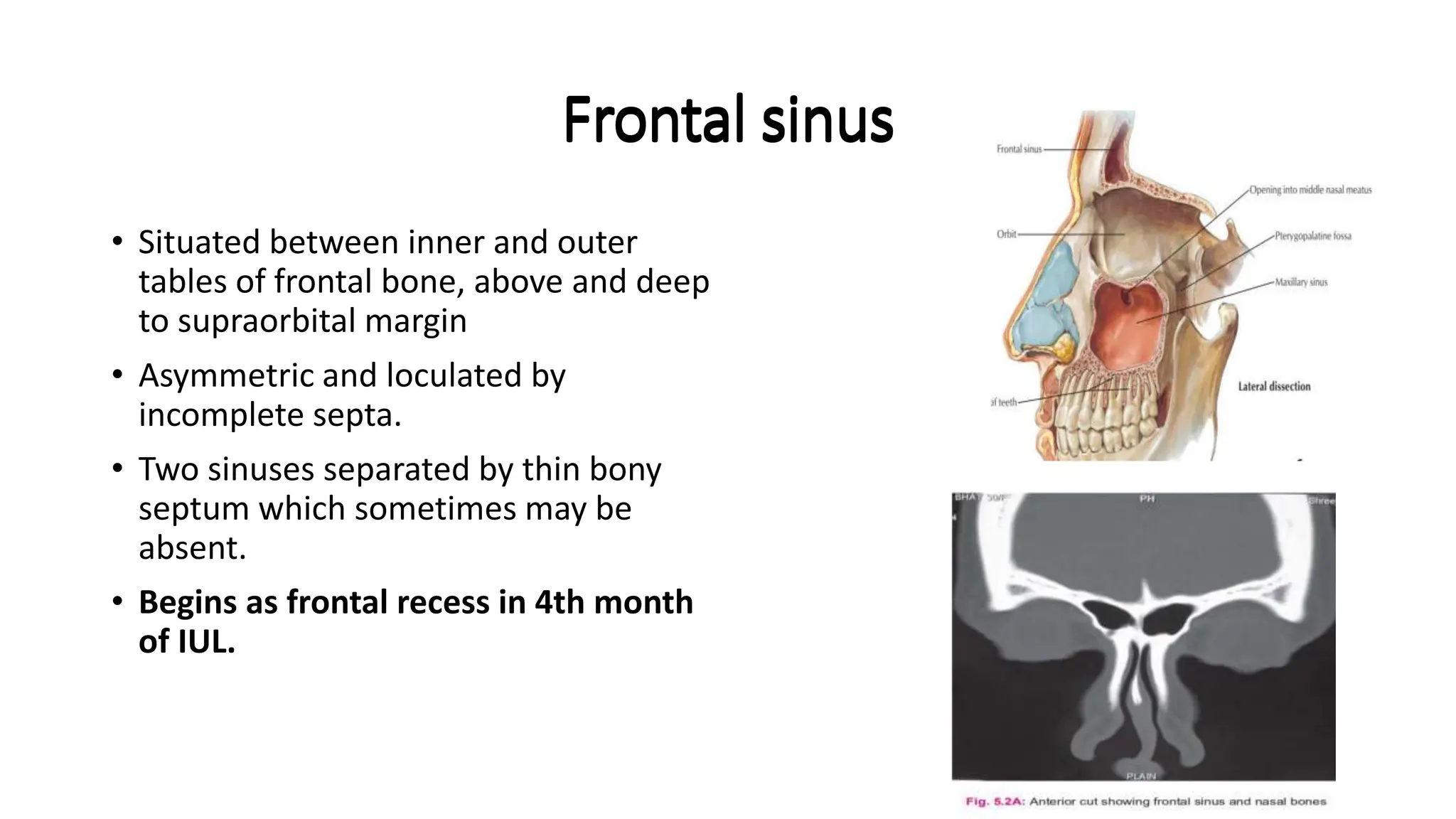 ANATOMY OF NOSE AND PARANASAL SINUSES.pptx