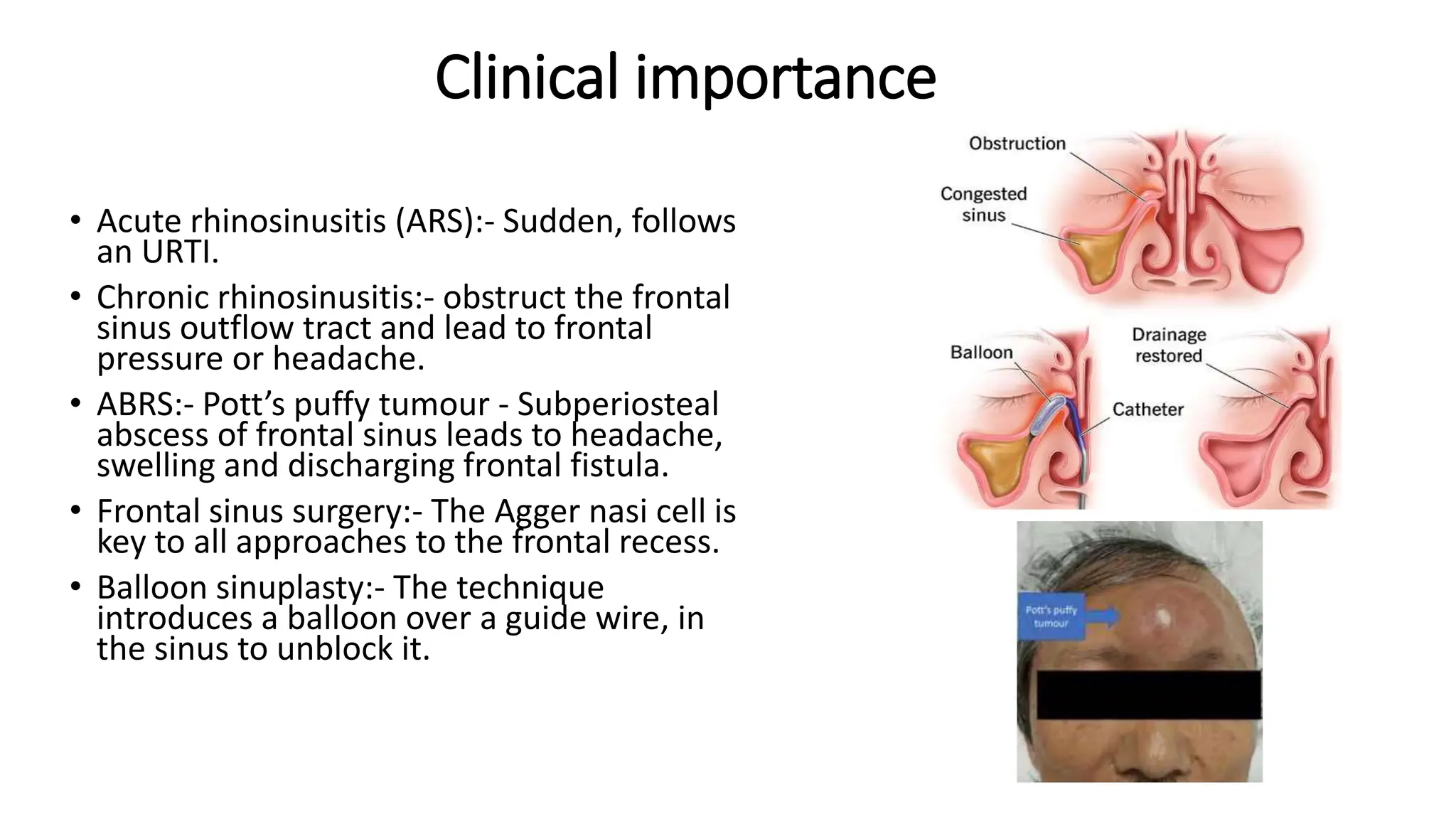 ANATOMY OF NOSE AND PARANASAL SINUSES.pptx