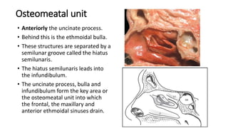 ANATOMY OF NOSE AND PARANASAL SINUSES.pptx