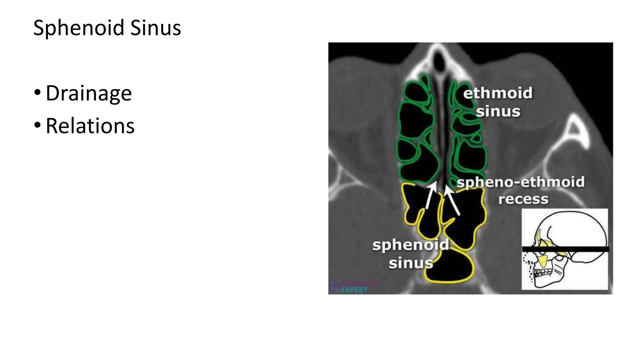 ANATOMY OF NOSE AND PARANASAL SINUSES.pptx