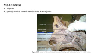 ANATOMY OF NOSE AND PARANASAL SINUSES.pptx
