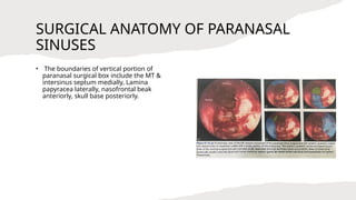 Anatomy of Nose and Paranasal sinuses.-Dr Vijay-Aiims kalyani.pptx