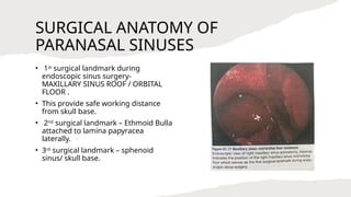 Anatomy of Nose and Paranasal sinuses.-Dr Vijay-Aiims kalyani.pptx
