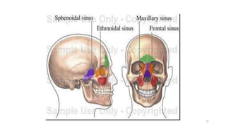 Anatomy of Nose And Paranasal Sinuses - Copy.pptx