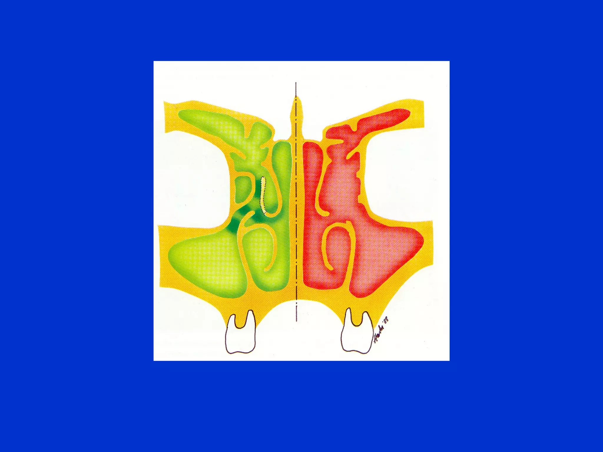 Anatomy of nose and paranasal sinuses | PPT