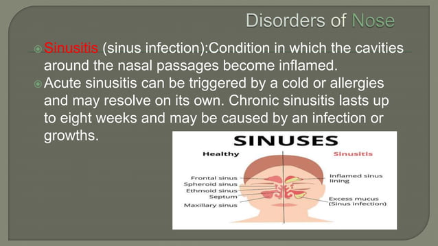 Anatomy of nose &functions & disorders | PPT