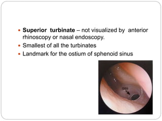 Anatomy of nose & paranasal sinuses | PPT