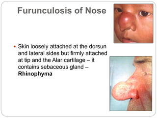 Anatomy of nose & paranasal sinuses | PPT