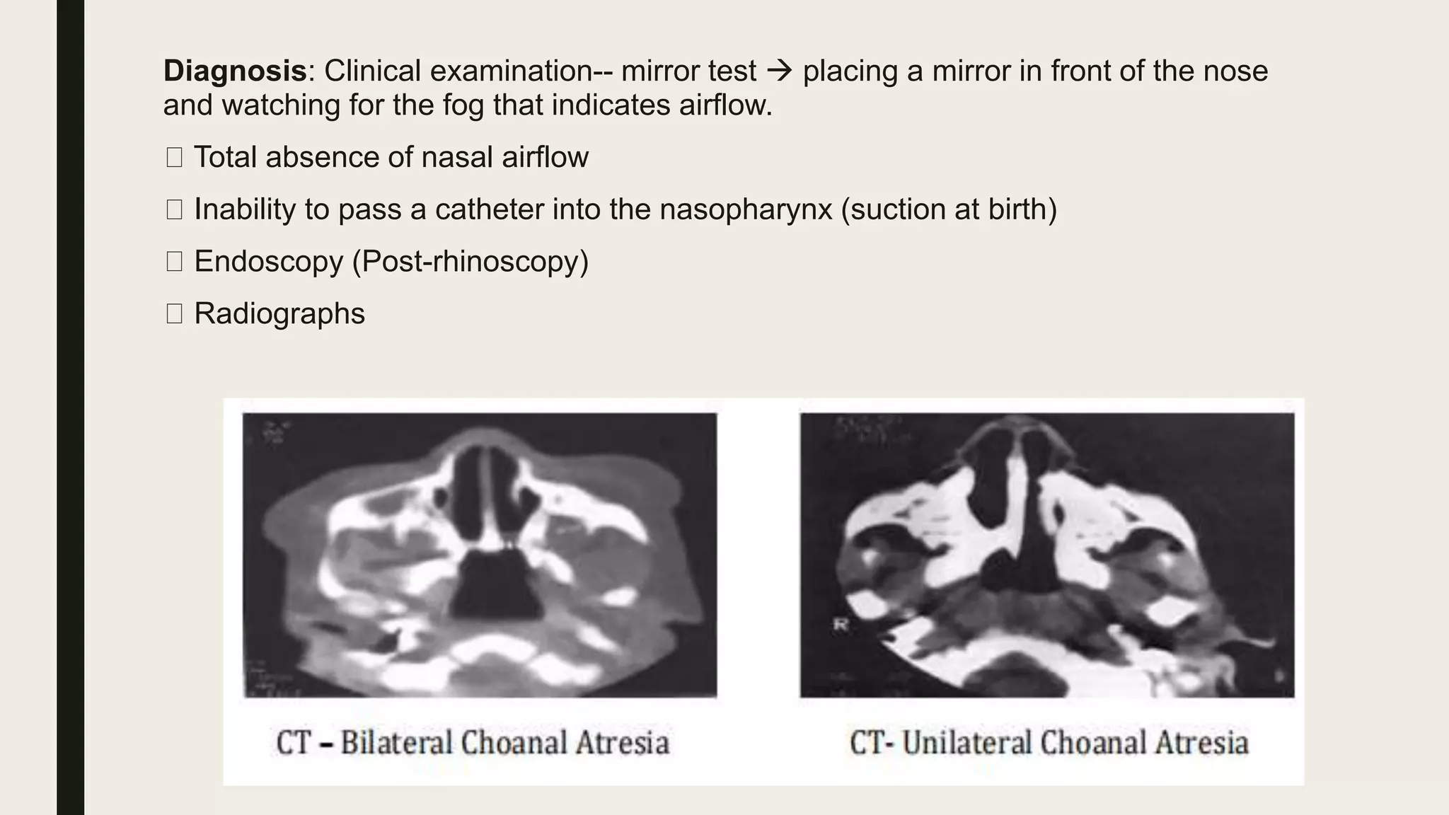 Anatomy of nose& PNS | PPTX