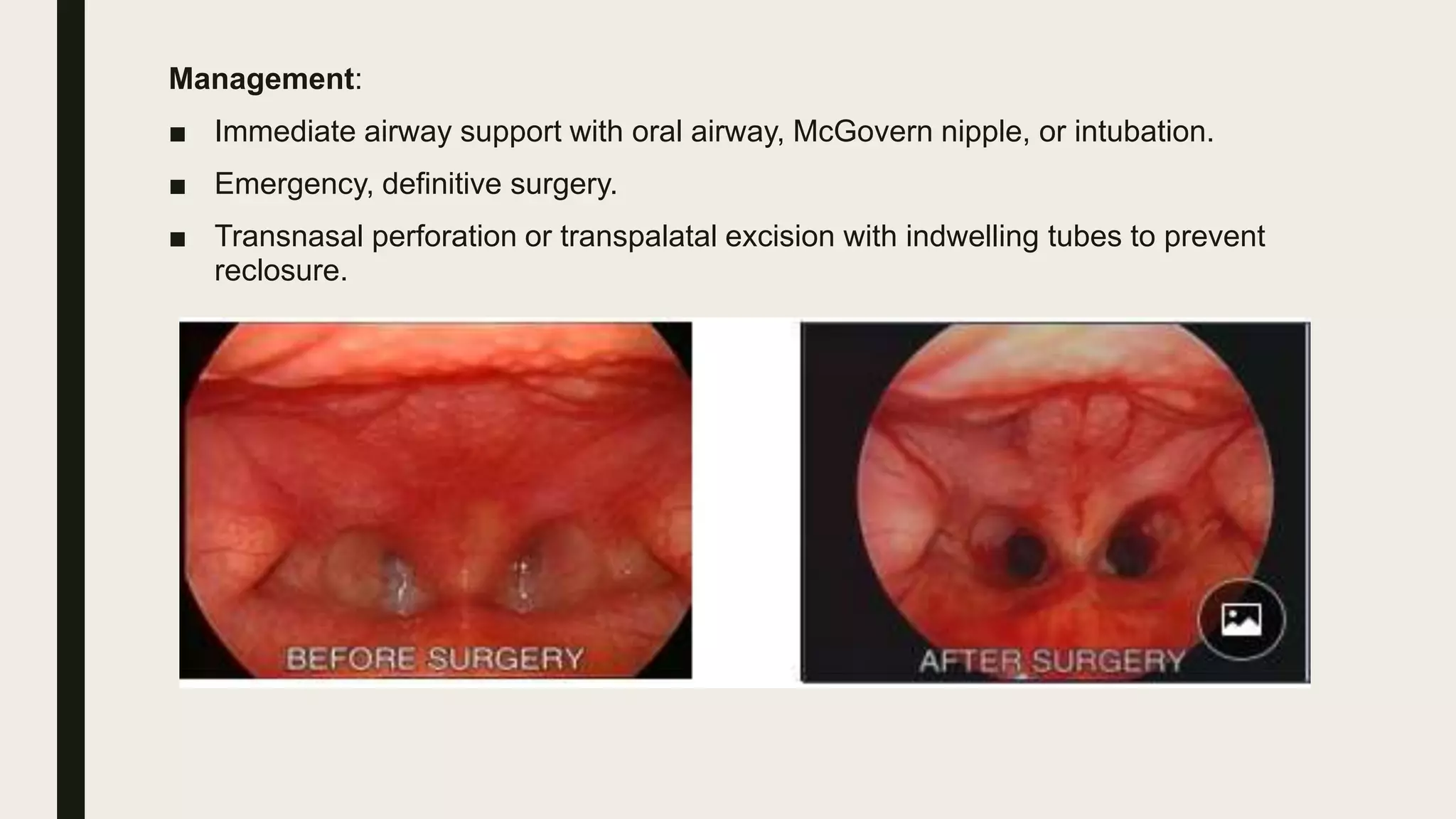 Anatomy of nose& PNS | PPTX