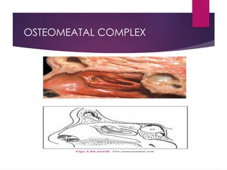ANATOMY OF NOSE and PARANASAL SINUSES ENT PG | PPTX