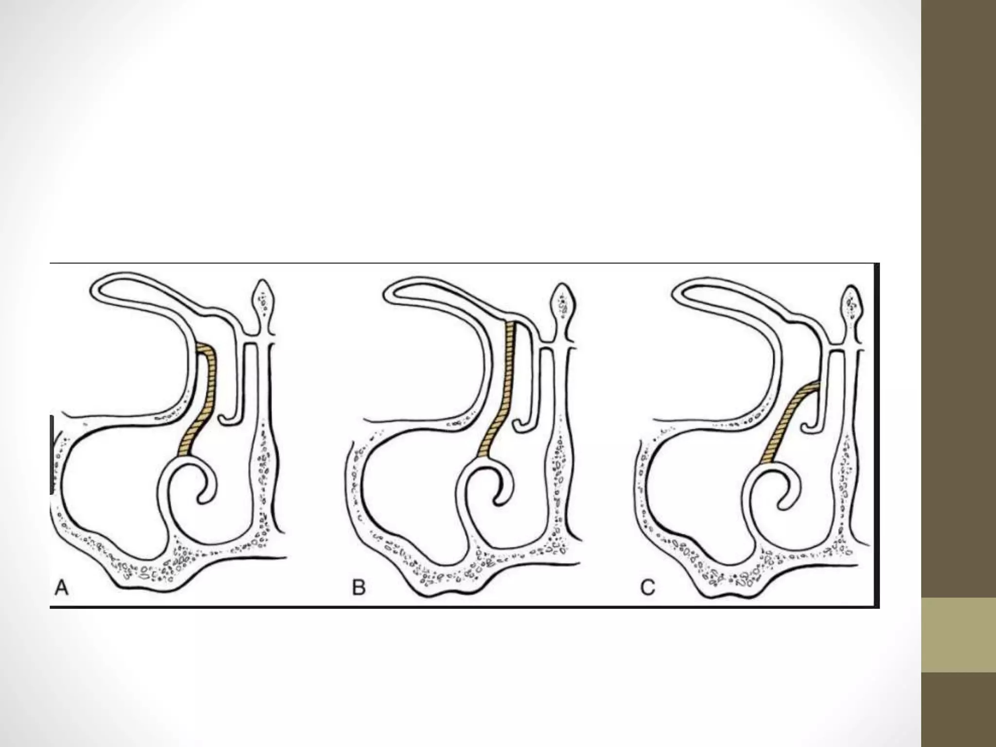 Anatomy of NASAL CAVITY related to FESS | PPTX