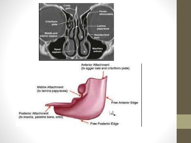 Anatomy of NASAL CAVITY related to FESS | PPT