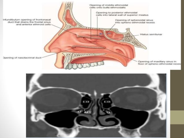 Anatomy of NASAL CAVITY related to FESS | PPT
